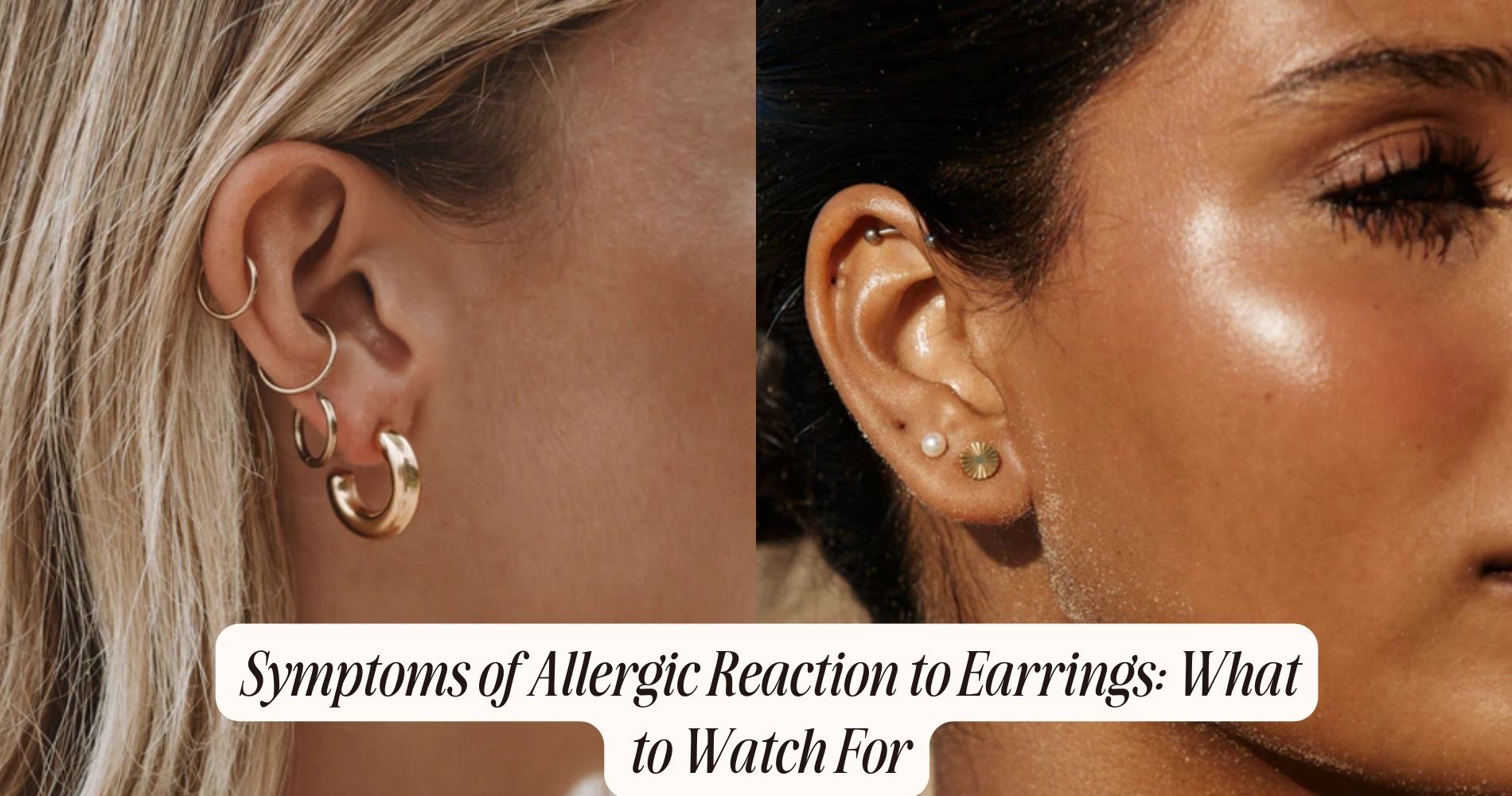 Symptoms of Allergic Reaction to Earrings: What to Watch For